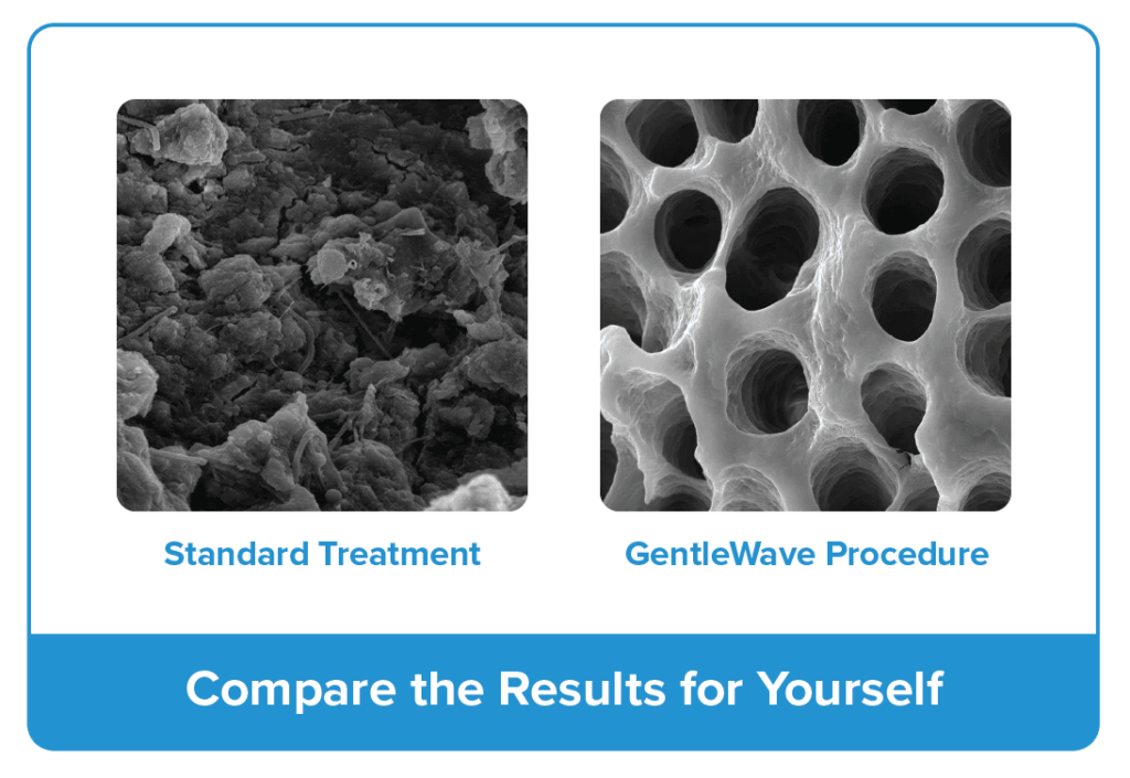 GentleWave Procedure in La Habra - North Orange County Dental Specialty ...